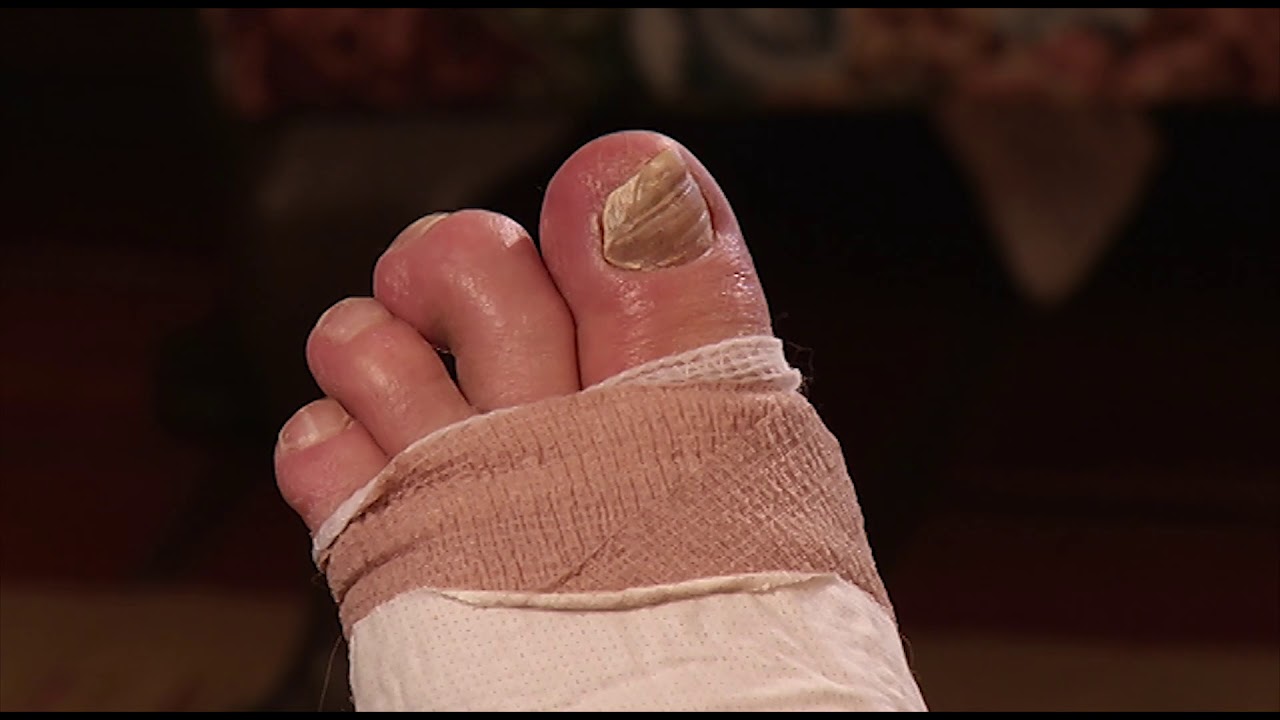 Putting Your Best Foot Forward: Tips for Healthy Feet - Ivanhoe ...