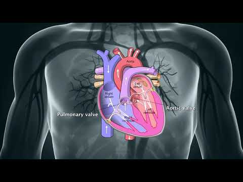 Ross Heart Procedure Lets Raj Save Raj! - Ivanhoe Broadcast News, Inc.