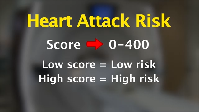 Heart Attack Alert: Know Your Coronary Calcium Score - Ivanhoe ...
