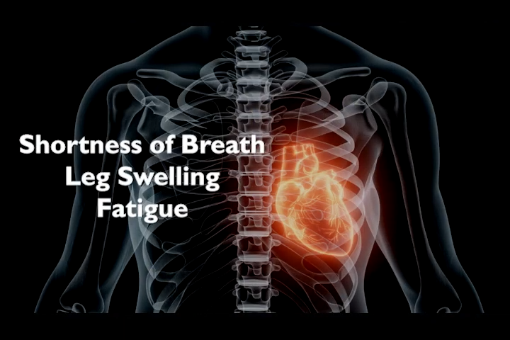 The Solution to Overlooking a Dangerous Heart Condition - Ivanhoe ...