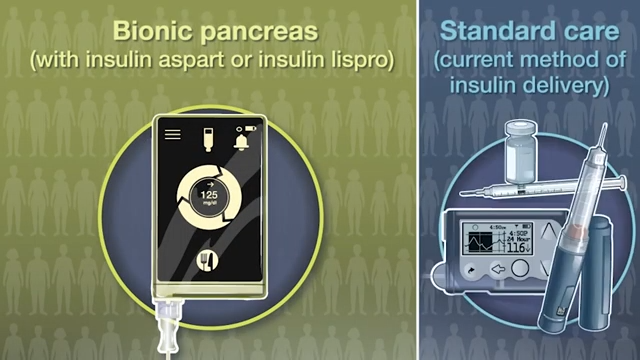 Building a Smarter Bionic Pancreas for Type 1 Diabetes - Ivanhoe ...