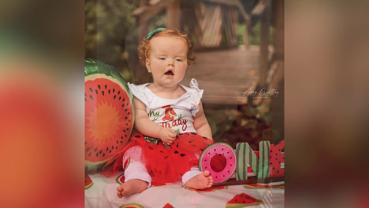 Rare Brain Surgery Stops Seizures in Baby Reagan - Ivanhoe Broadcast ...